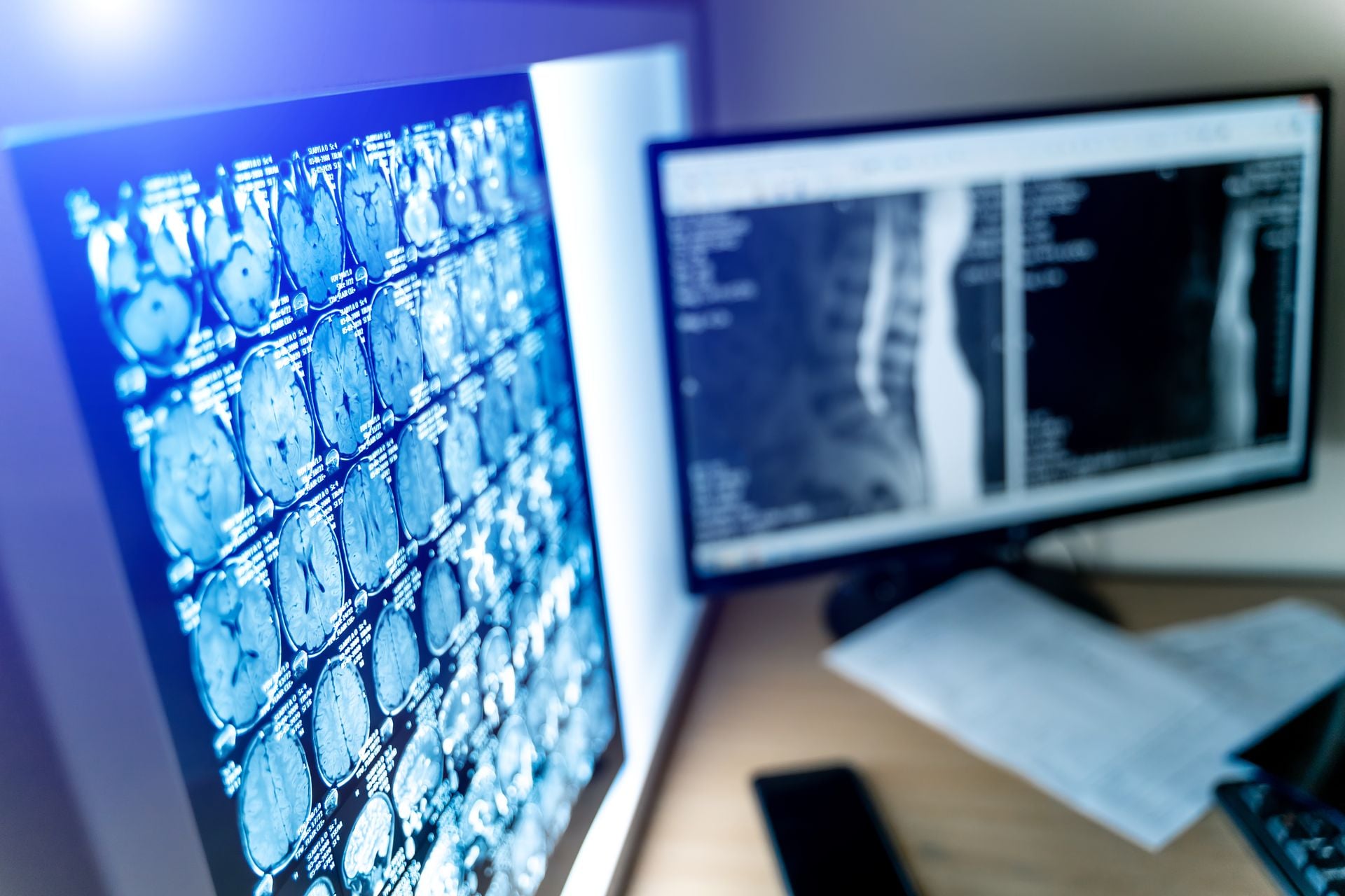 What Your Radiology Report Really Means: Common Terms Explained