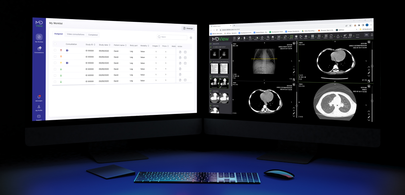 White Label Second Opinion Platform | MDView