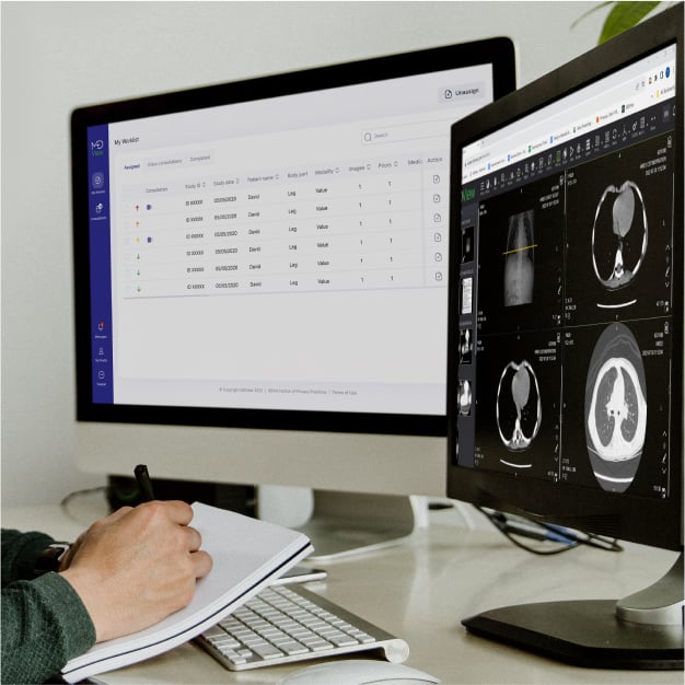 Get Expert Radiology Report Results Fast with MDView